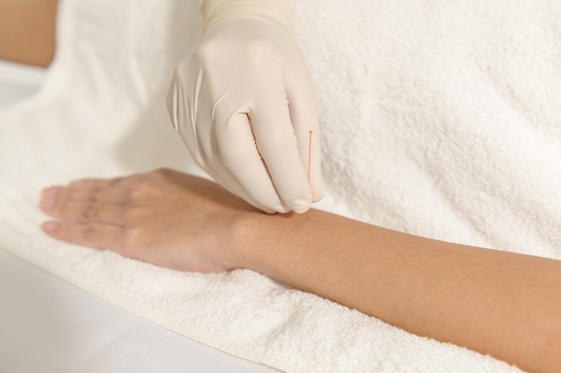 Basics of Acupuncture - Sass Magazine