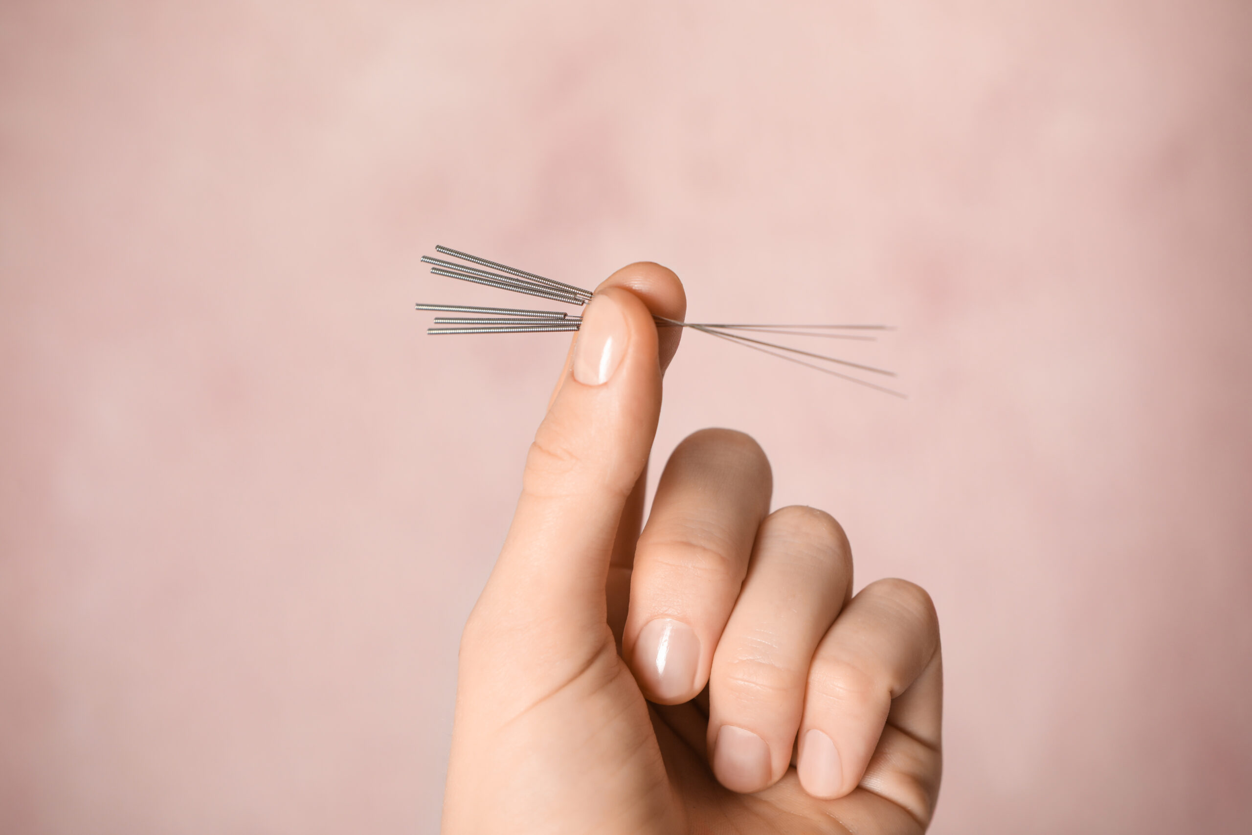 Basics of Acupuncture - Sass Magazine